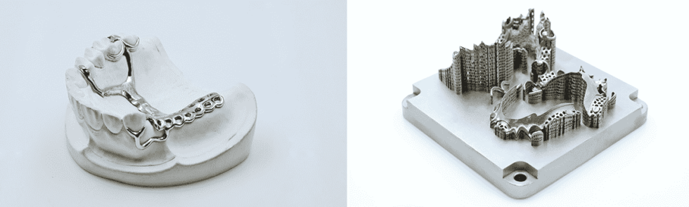 Partial Dentures | Mabel Dental Labs