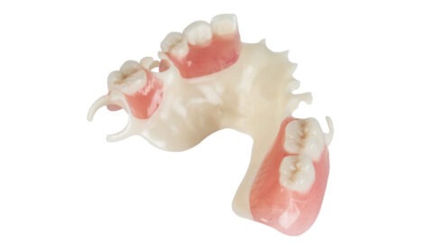 Partial Dentures | Mabel Dental Labs