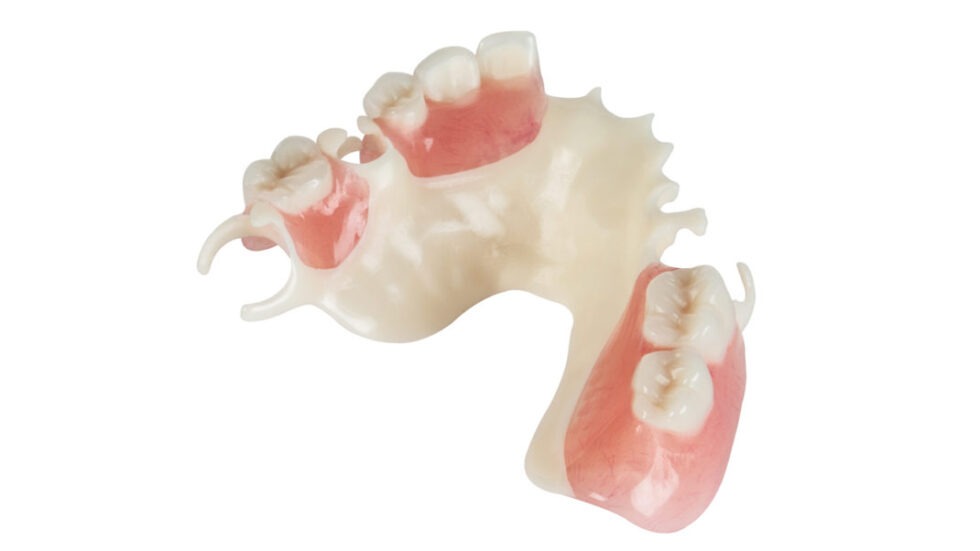 Partial Dentures | Mabel Dental Labs