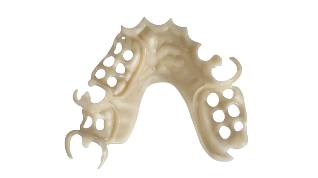 Partial Dentures | Mabel Dental Labs