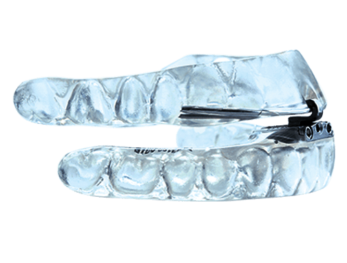 Sleep Apnea Devices - Mabel Dental Lab